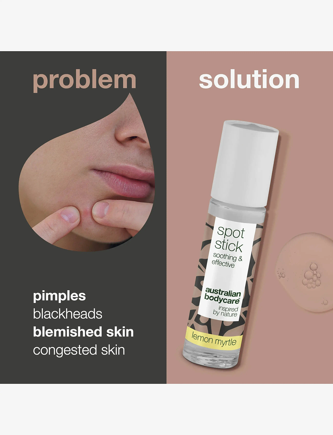 Australian Bodycare Spot Stick For Pimples & Blackheads - Lemon Myrtle ...