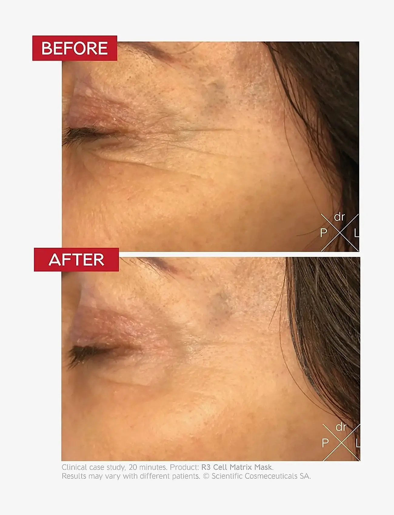 Dr. Levy R3 Cell Matrix Mask (White) - 895 kr | Boozt.com