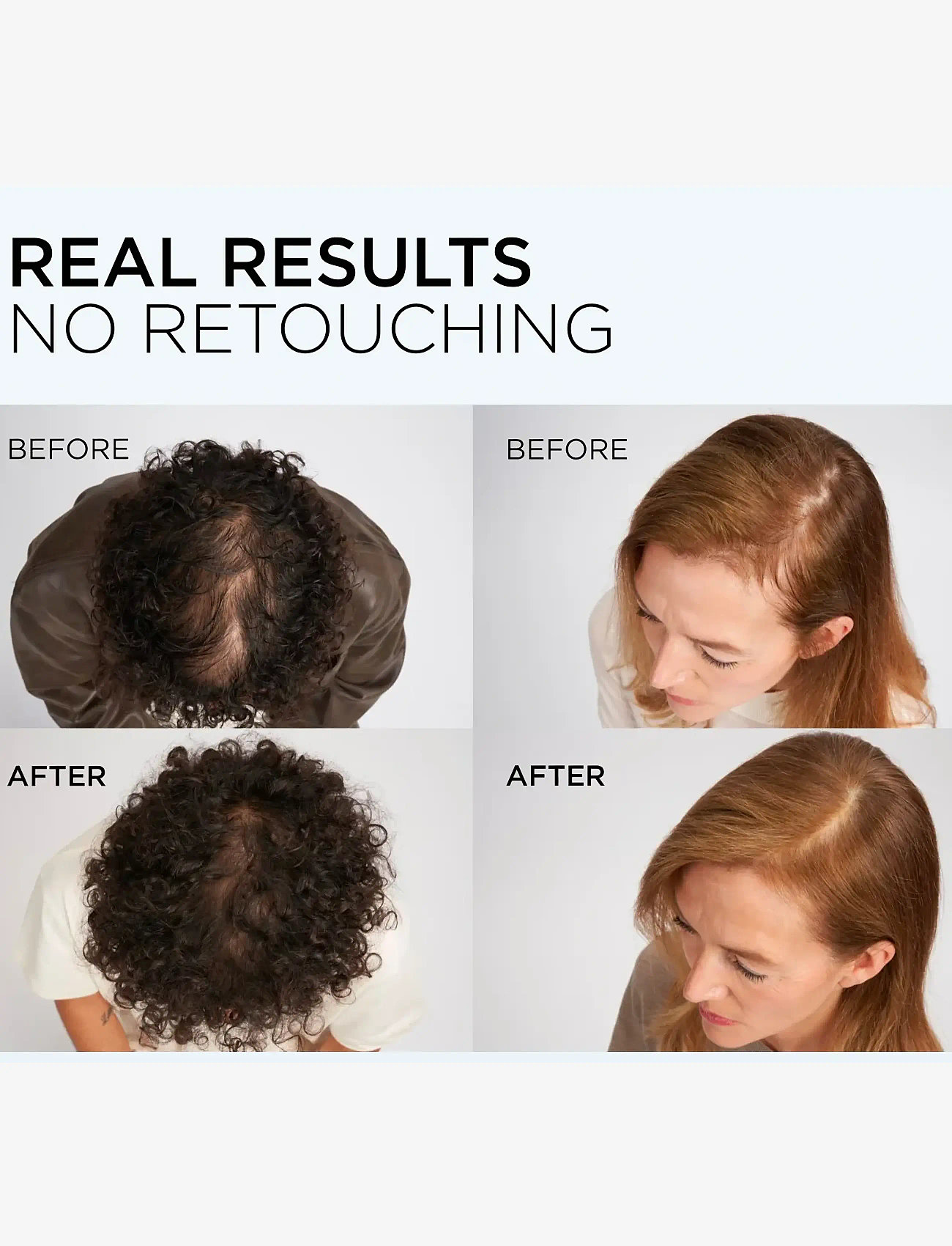 L'Oréal Paris L'oréal Paris Elvital Growth Booster Hair Serum Against ...